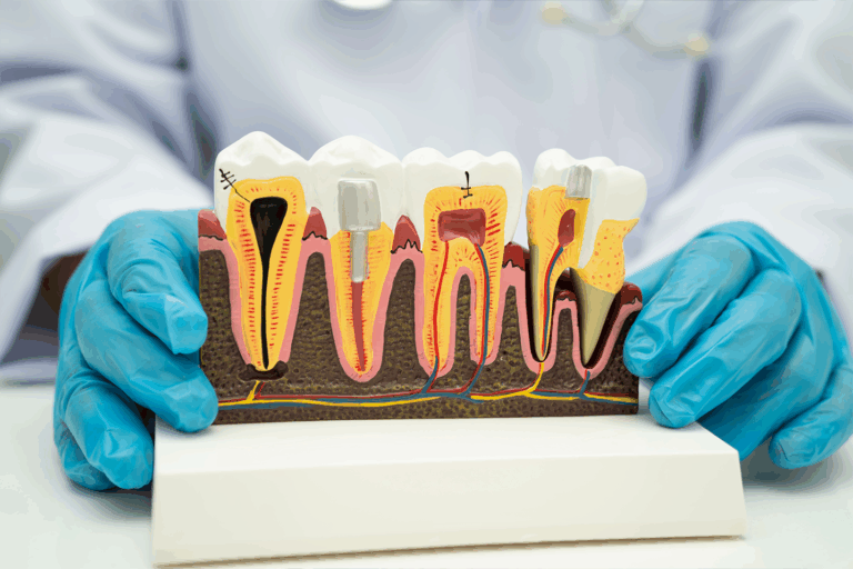 Root Canal Middlesex, NJ - Advanced Dentistry - Root Canal Treatment in ...